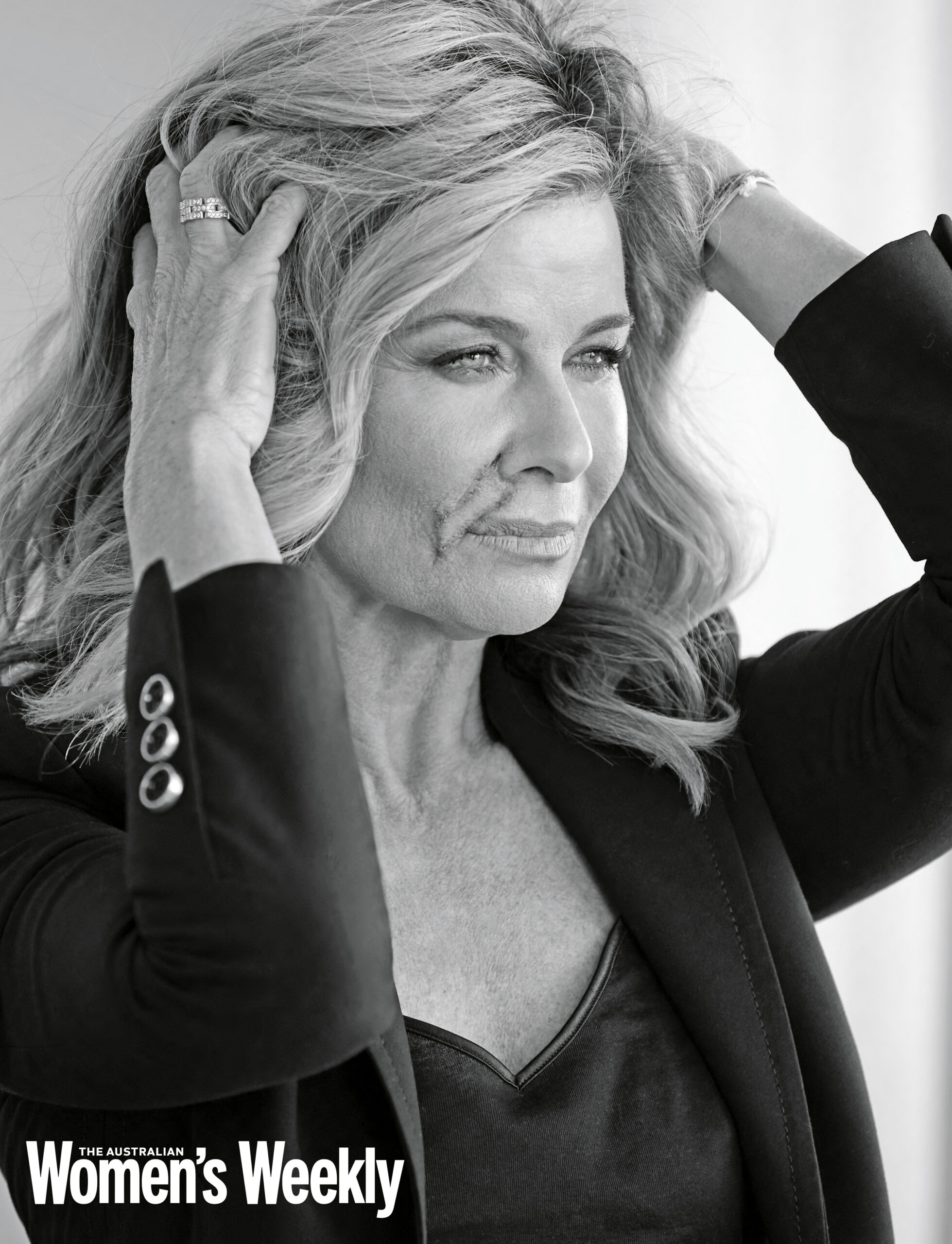 Deborah Hutton on her skin cancer: "It has frightened me" | AWW